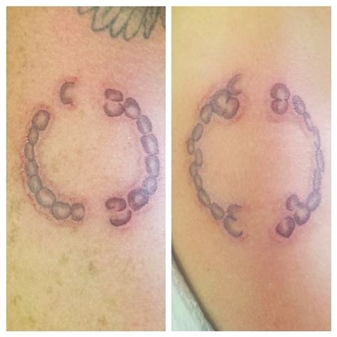 Top 119 Human Bite Mark Tattoo
