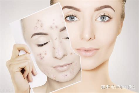 卢尔曼知识分享家：如何正确使用洁面产品？ 知乎