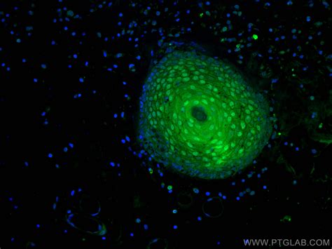 Crabp2 Antibody 66468 1 Ig Proteintech
