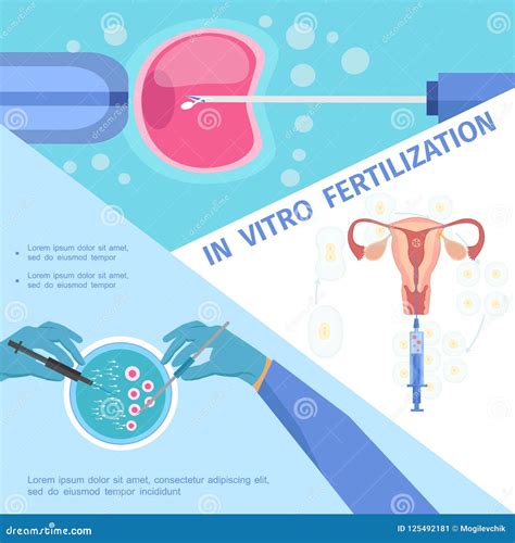 Flat In Vitro Fertilization Medical Concept Stock Vector Illustration