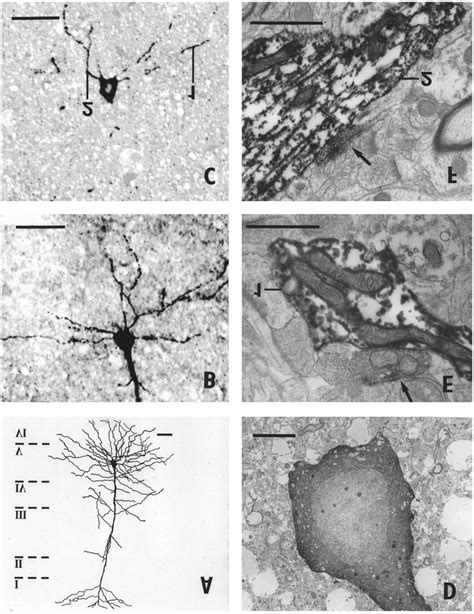Morphological And Immunocytochemical Properties Of A Biocytin Labeled