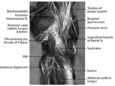 Posterior Interosseous Nerve