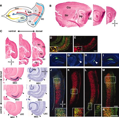 Entorhinal Cortex