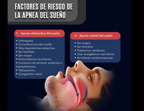 Sleep Apnea Relief Treat And Prevent 120 Capsules Made In Usa My
