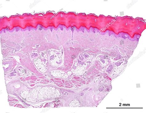 Low Power Light Microscope Micrograph Of Human Glabrous Skin From Top