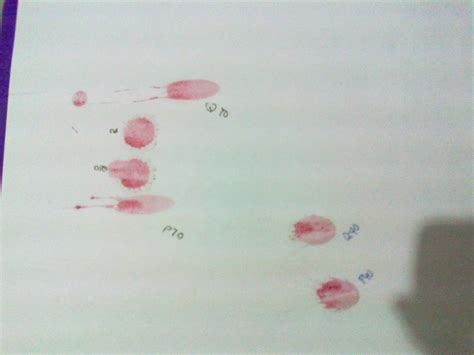 Csi Module Entry 7 Passive Blood Stains