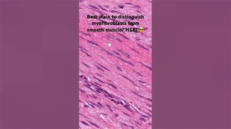Myofibroblasts Fibroblasts Vs Smooth Muscle 101 Histology Pathology
