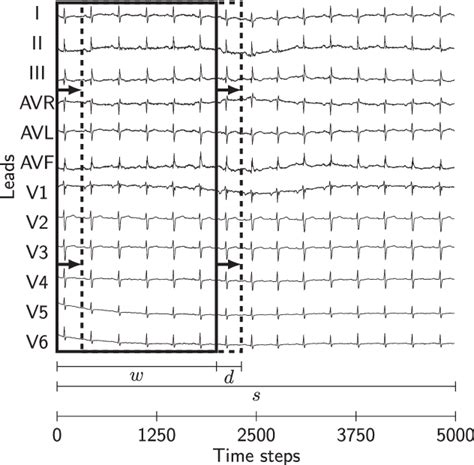 Figure 1 From Detecting Myocardial Scar Using Electrocardiogram Data And Deep Neural Networks