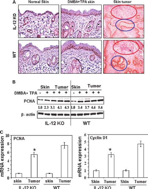 Il 12 Deficiency Suppresses Tpa Induced Inflammatory Responses In Terms