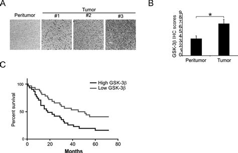 Expression Of Glycogen Synthase Kinase 3b Gsk 3b In Breast Cancer