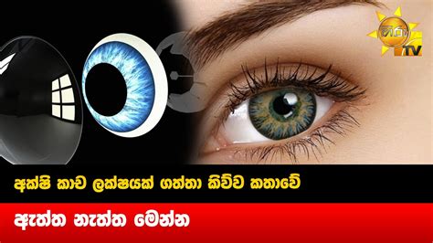 අක්ෂි කාච ලක්ෂයක් ගත්තා කිව්ව කතාවේ ඇත්ත නැත්ත මෙන්න Hiru News Youtube
