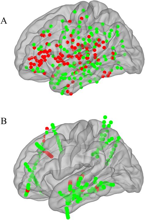 Epilepsy Grid Mapping Protocol Pooterfinance