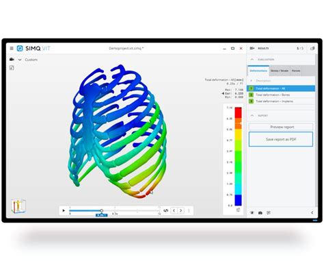 Simq Gmbh Auf Linkedin Simq Patient Computer