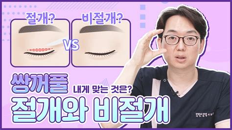쌍꺼풀 절개 비절개 중 내게 맞는 것은 Youtube