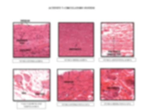 Solution Histopathology Circulatory System Studypool