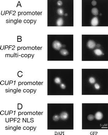 Transcript Selection And The Recruitment Of MRNA Decay Factors For NMD In Saccharomyces Cerevisiae