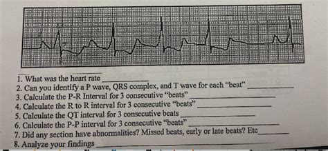 What Was The Heart Rate Can You Identify A P Chegg