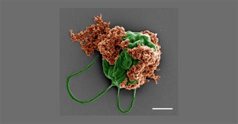 Microrobots Deliver Cancer Drugs To Lung Tumors In Mice