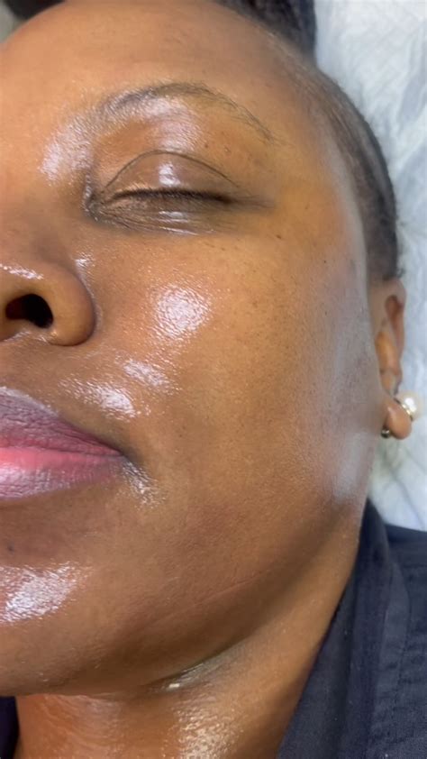 Dr Nokubonga Khoza Dermatology And Laser Skin Health Is An Incredibly