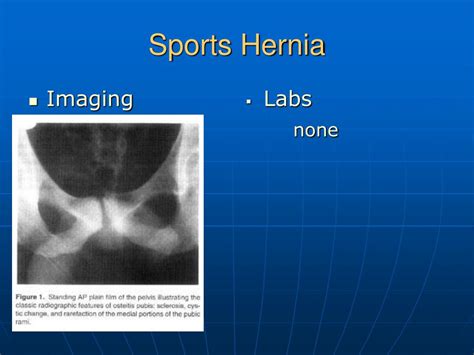 Sports Hernia Athletic Pubalgia Sports Hernia 1 Youtube Again