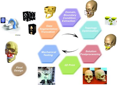 The Workflow Of Using Structural Topology Optimization For Craniofacial Download Scientific