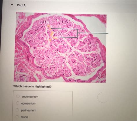 Solved Part A Which Tissue Is Highlighted Endoneurium
