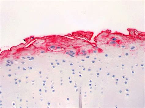 Medical Device Specialized Histology
