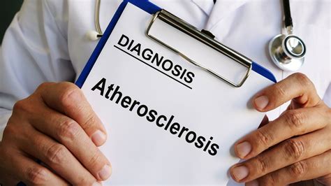Скрининг за атеросклероза