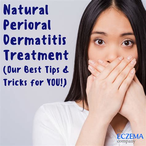 Is Perioral Dermatitis Contagious Know The Treatment Home Remedies For