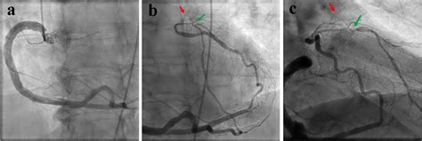 J Med Cases