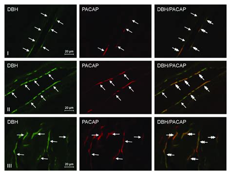 Representative images of the immunocytochemical localization of DβH and Download Scientific