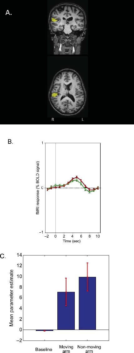 A Shows The Location Of The Right Hemisphere Parietal Operculum Voi Download Scientific