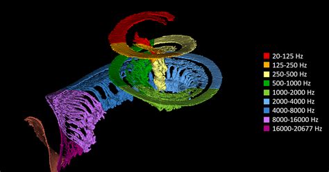 Feature Pitch Perfect New Tool Helps To ‘tune Cochlear Implants To