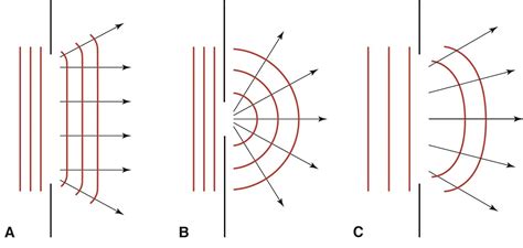 Diffraction American Academy Of Ophthalmology