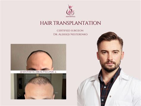 Hair Transplantation Aestheticalv