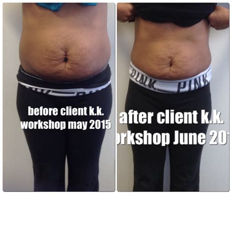 All New Before And After Pictures Healing The Diastasis Recti 2015