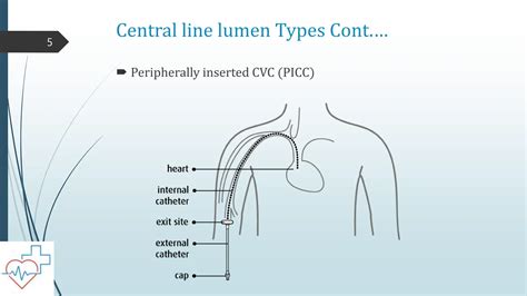 Central Venous Catheter Introductiopptx