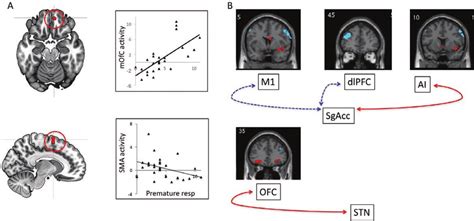 Neural Correlates Of Waiting Impulsivity In The Monetary Incentive