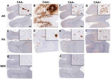Immunohistochemical Characterization Of Aβ1 40 And Aβ1 42 In
