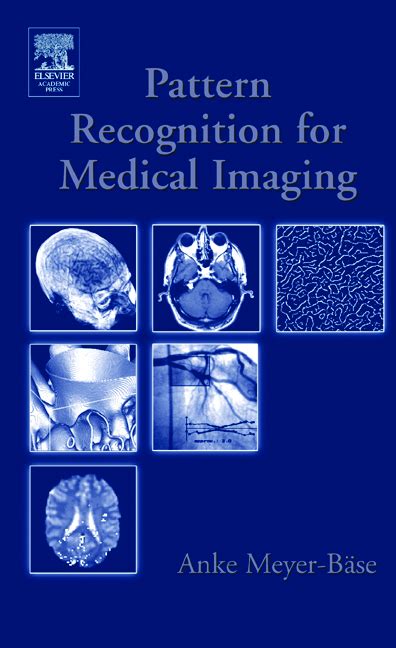 Pattern Recognition And Signal Analysis In Medical Imaging Edition 1