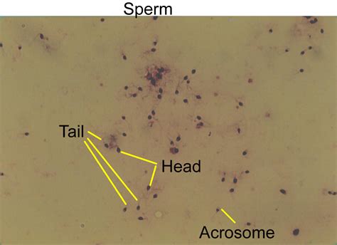 Sperm Cell Under Microscope Labeled