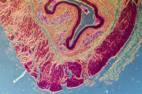 Imágenes De Epitelio Escamoso Estratificado Descarga Imágenes