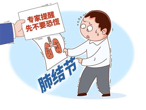 中国医学科学院肿瘤专家：普通人体检发现肺部结节不要过于恐慌，大多数是良性的薛奇防治治疗