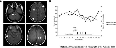 Brain Imaging And Clinical Course Of The Patient A Axial Brain