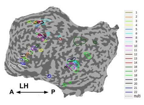 Level Of Inter Subject Variability In The Left Hemisphere In The