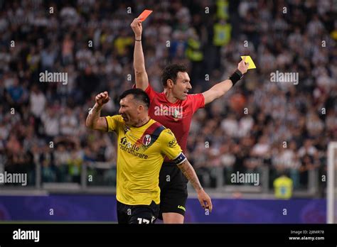 Gary Medel Of Bologna Fc Reacts After Being Shown A Red Card By The