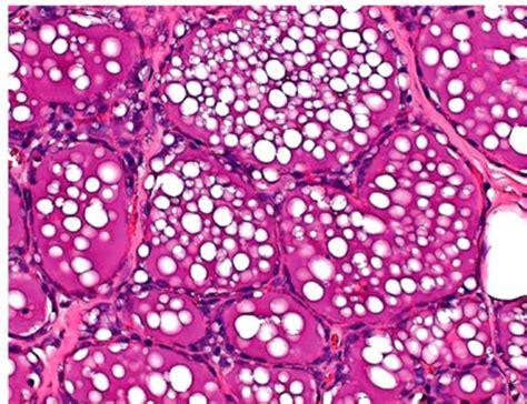 Table 1 From Spontaneous Mammary Tumors In Domestic Rats Rattus