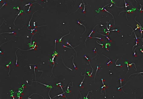 基因工程小鼠精子活力检测 知乎