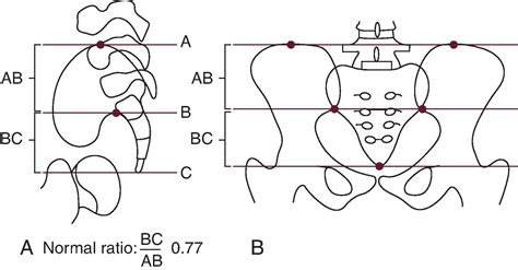 Congenital Anorectal Malformations And Hirschsprung Disease In The