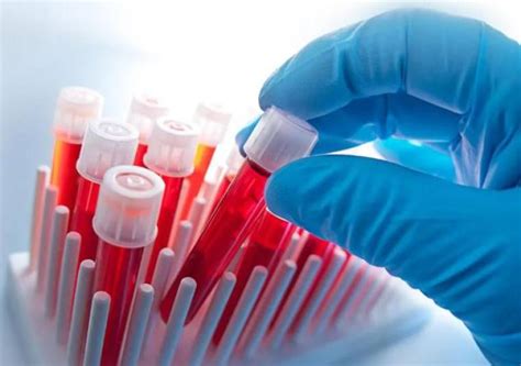 СУДАЛГАА ХОРТ ХАВДРААС СЭРГИЙЛЭХ ЭРТ ИЛРҮҮЛЭГТ ХҮН АМЫН 31 ХАМРАГДААД БАЙНА